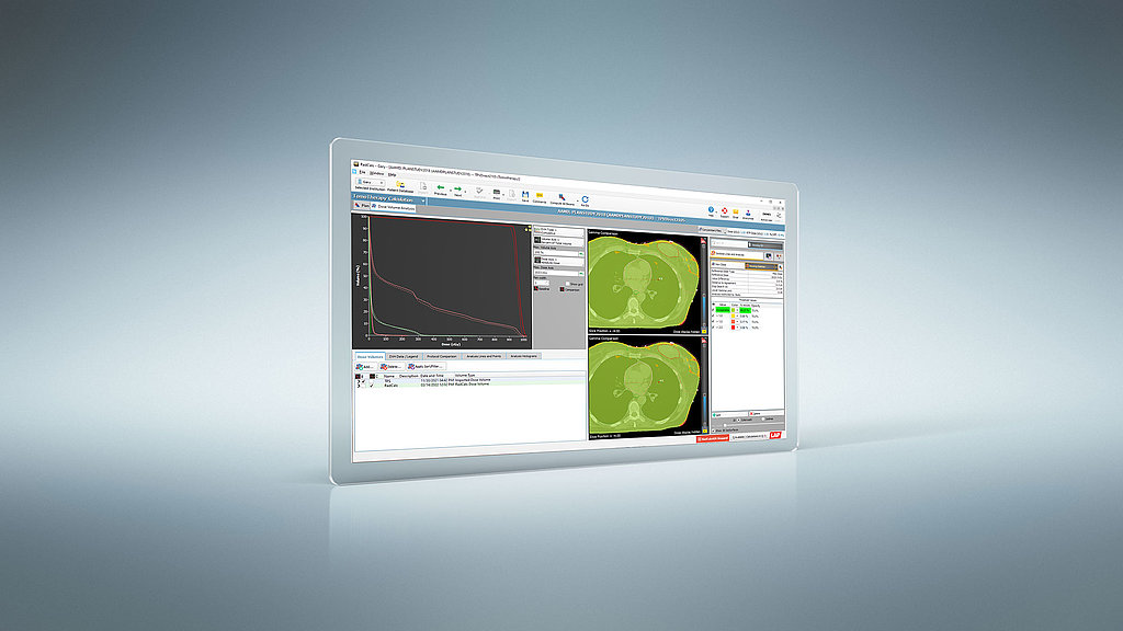 Webinar: Automated patient QA using RadCalc software for helical ...